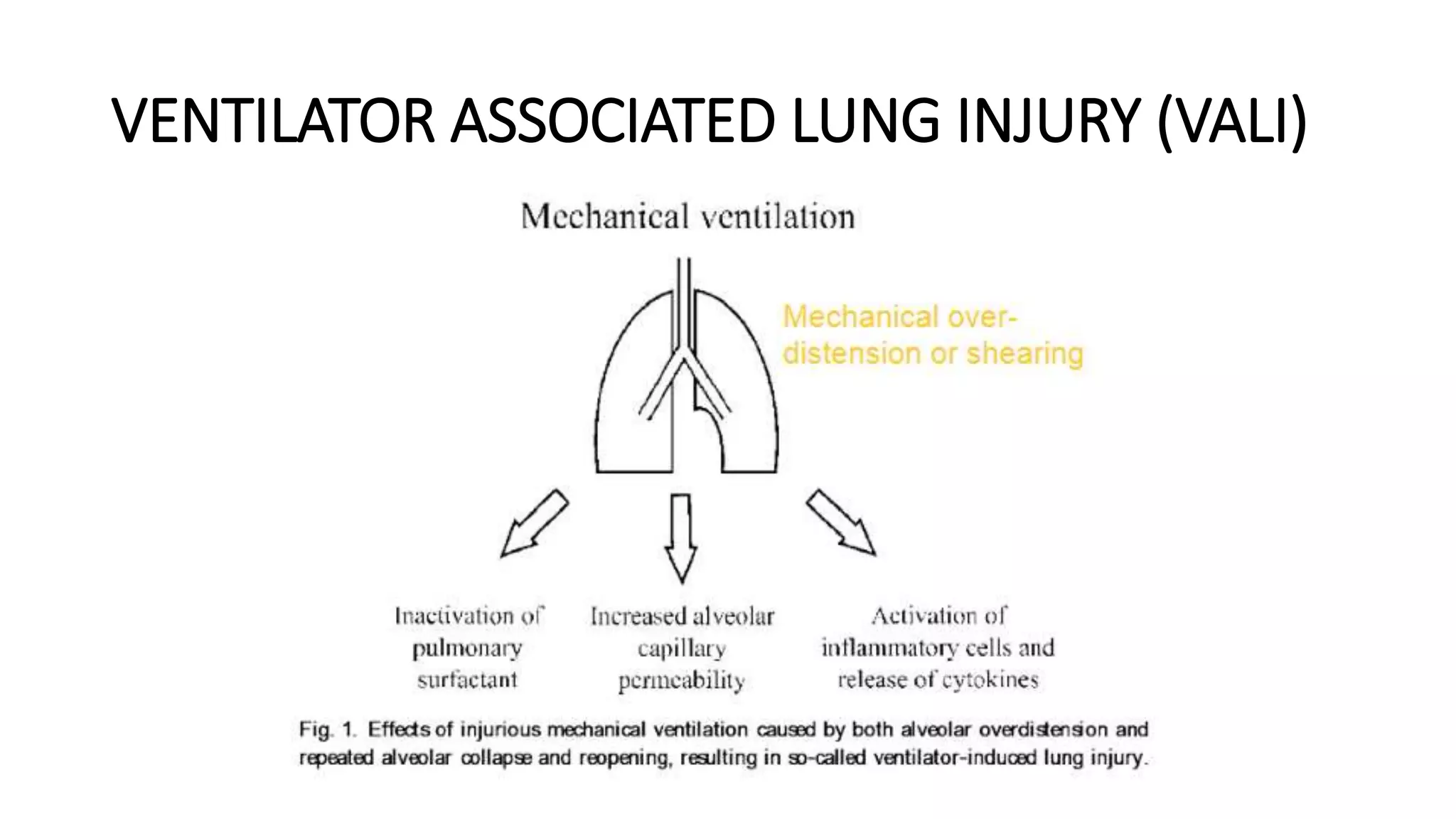 Chronic obstructive pulmonary disease | PPTX