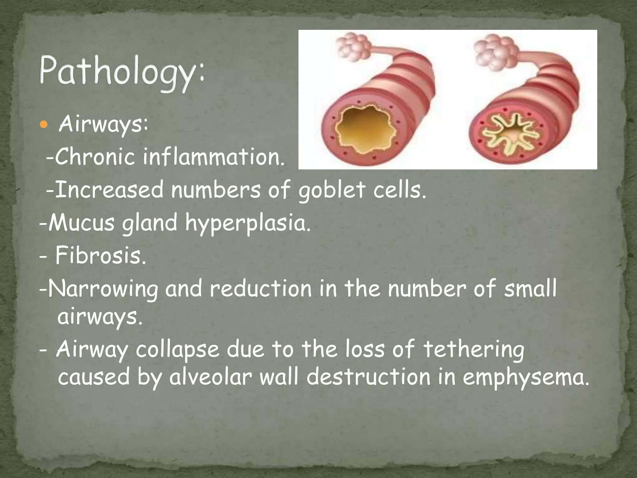 Chronic obstructive pulmonary disease | PPTX