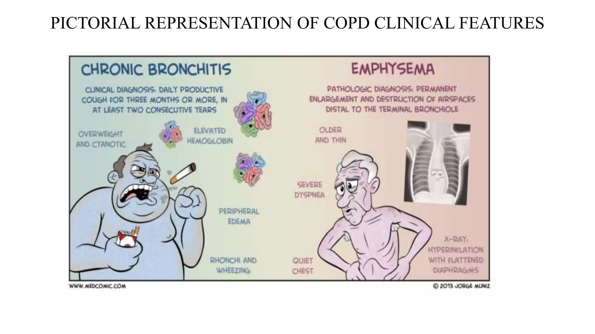 Physiotherapy management of chronic obstructive pulmonary disease ppt ...
