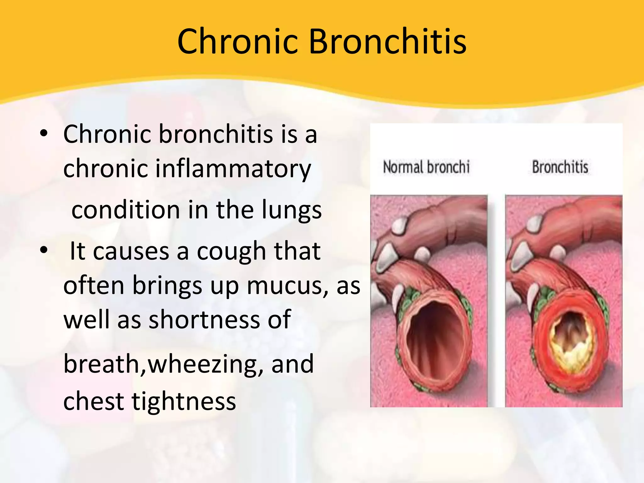 Chronic Obstructive Pulmonary Disease (Copd) | PPTX