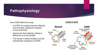 Chronic Obstructive Pulmonary Disease (COPD) 1.pptx
