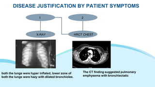 Chronic Obstructive Pulmonary Disease (COPD) case report.pptx