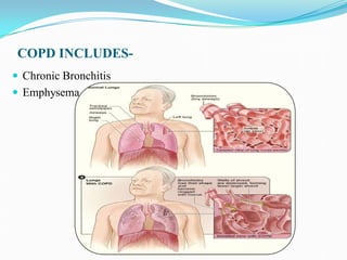 Chronic obstructive pulmonary disorder | PDF