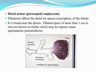 Chronic obstructive pulmonary disorder | PDF