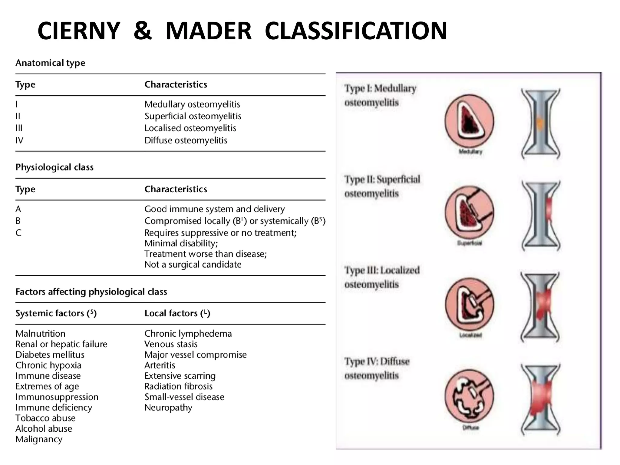 CHRONIC OSTEOMYELITIS | PPTX