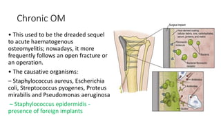 chronic OM.pptx