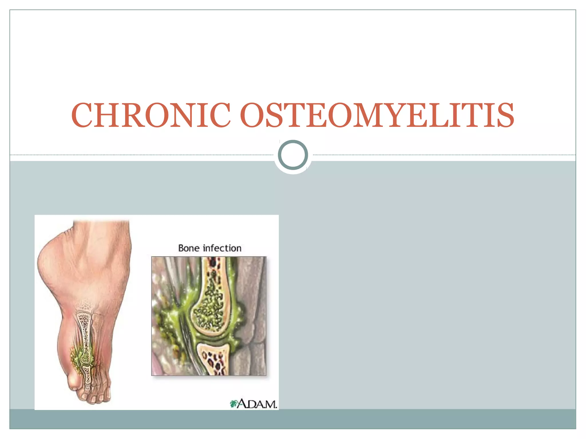 Chronic osteomyelitis | PPT