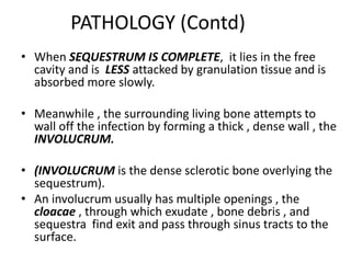 Chronic osteomyelitis | PPTX