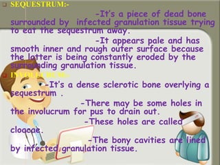 Chronic osteomyelitis | PPT
