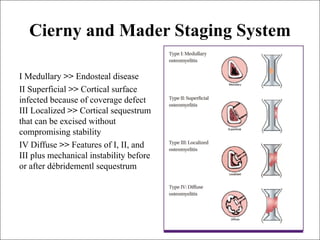 Chronic osteomy lllhhhhhhhhhhhhhhhhelitis (2).pdf
