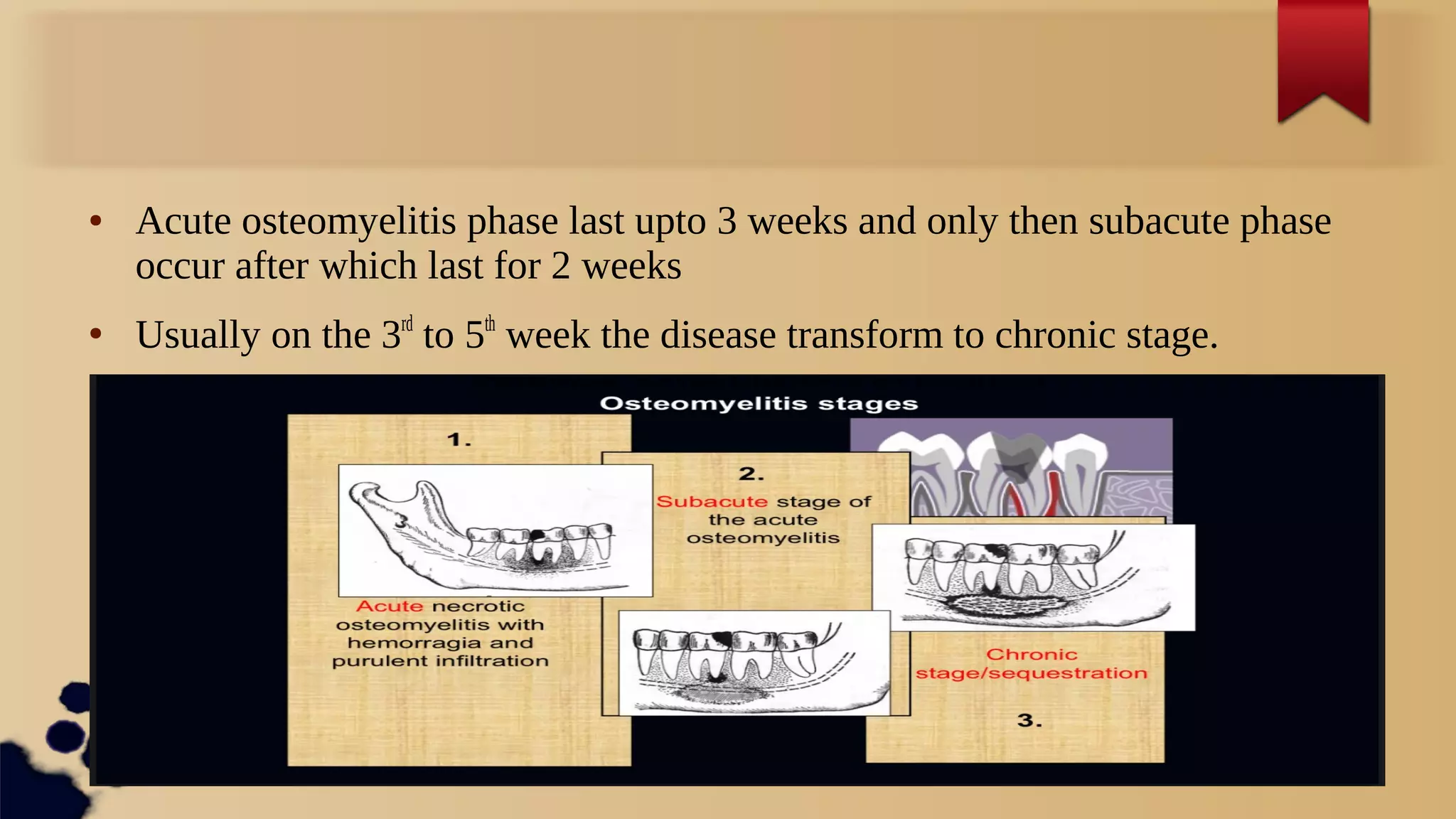 Chronic and subacute osteomyelitis | ODP