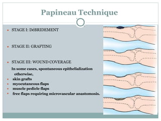 chronicosteomyelitis Powerpt power point | PPTX