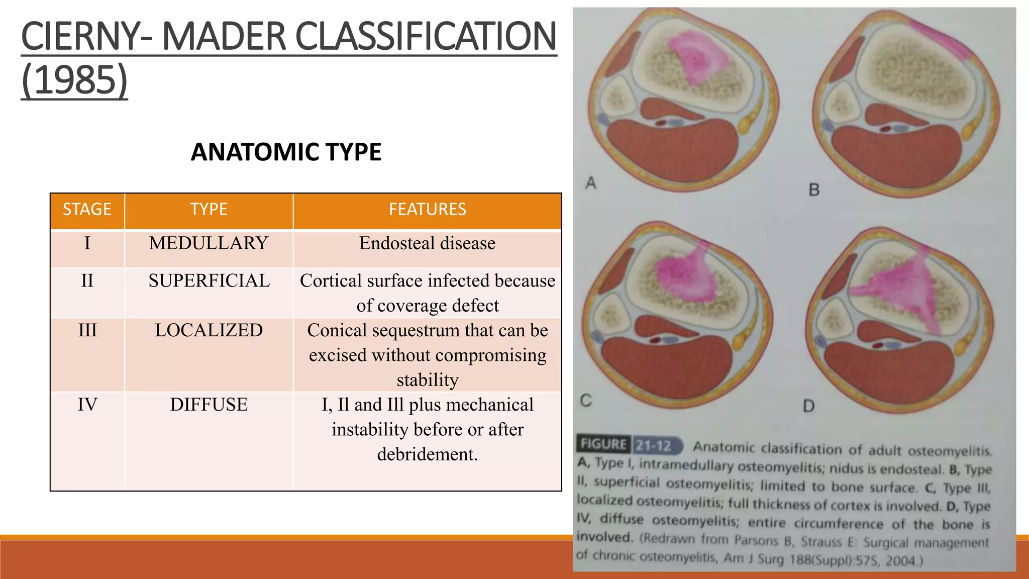 Chronic osteomyelitis seminar and case report ortho patho | PPTX