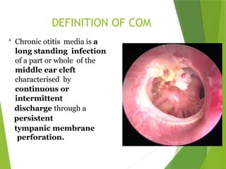 chronicotitismedia-200524175225.abctpptx | PPTX