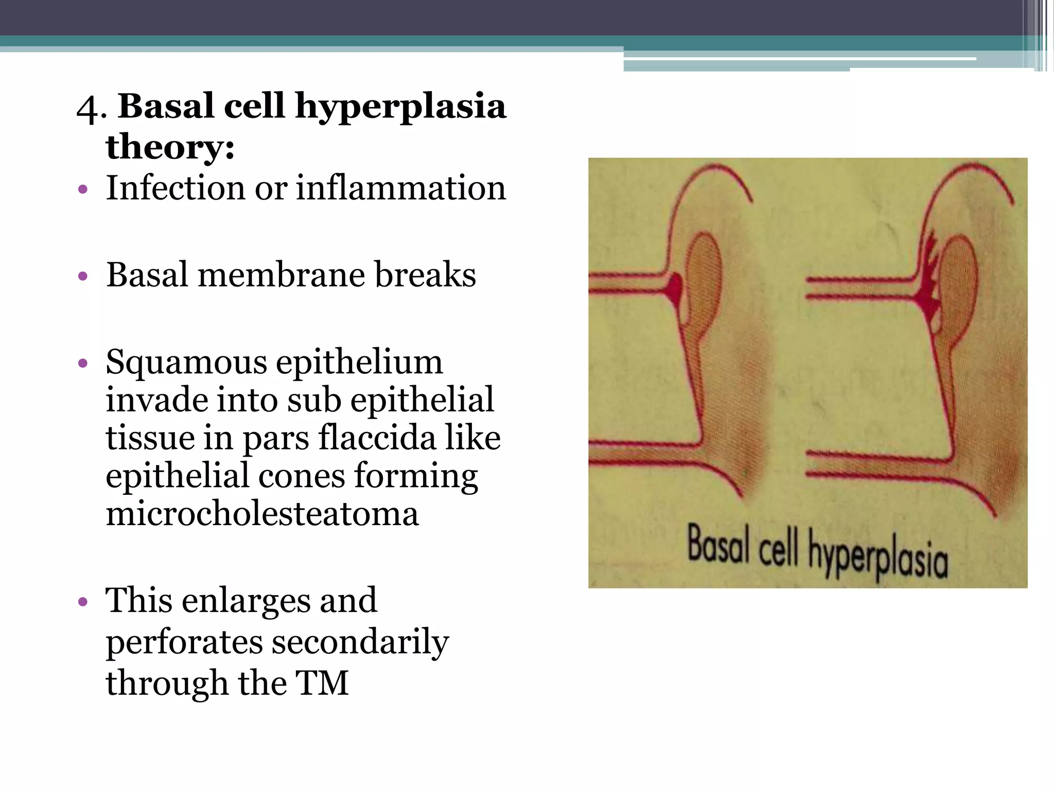 Chronic Otitis Media | PPTX