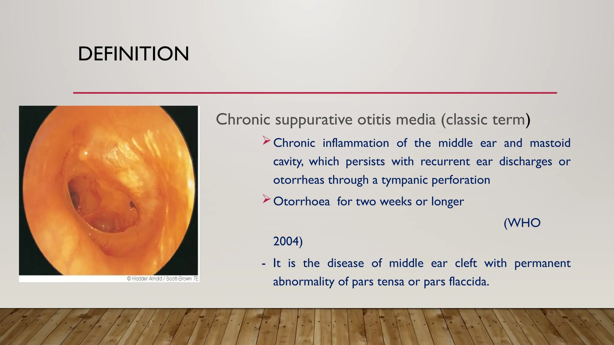 Chronic otitis media- Mucosal chronic chronic media idk | PPTX