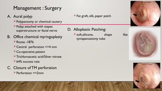 Chronic otitis media- Mucosal chronic chronic media idk | PPTX