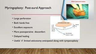 Chronic otitis media- Mucosal chronic chronic media idk | PPTX