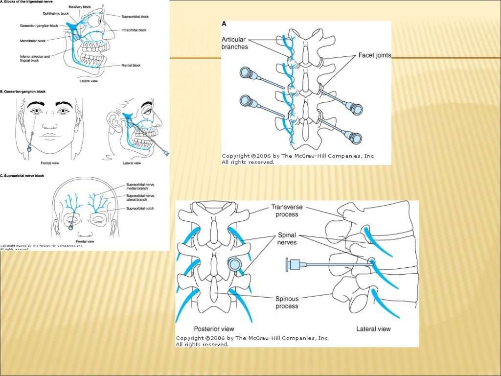 Pain Management Diagram