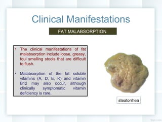 Chronic Pancreatitis | PPT | Digestive Disorders | Diseases and Conditions