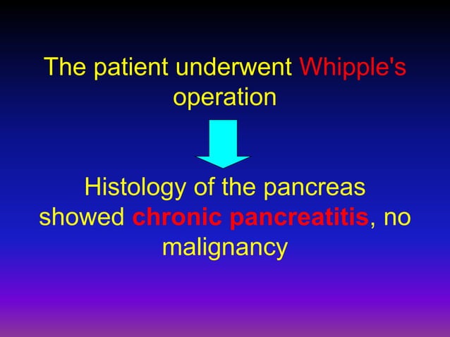 chronic pancreatitis.ppt