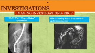 Chronic pancreatitis/ Epigastric pain | PPTX