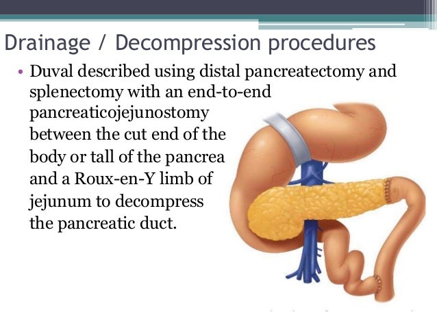 Chronic pancreatitis