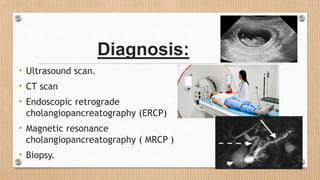 Chronic pancreatitis - histology.pptx