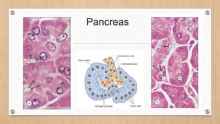 Chronic pancreatitis - histology.pptx