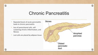 Chronic pancreatitis - histology.pptx