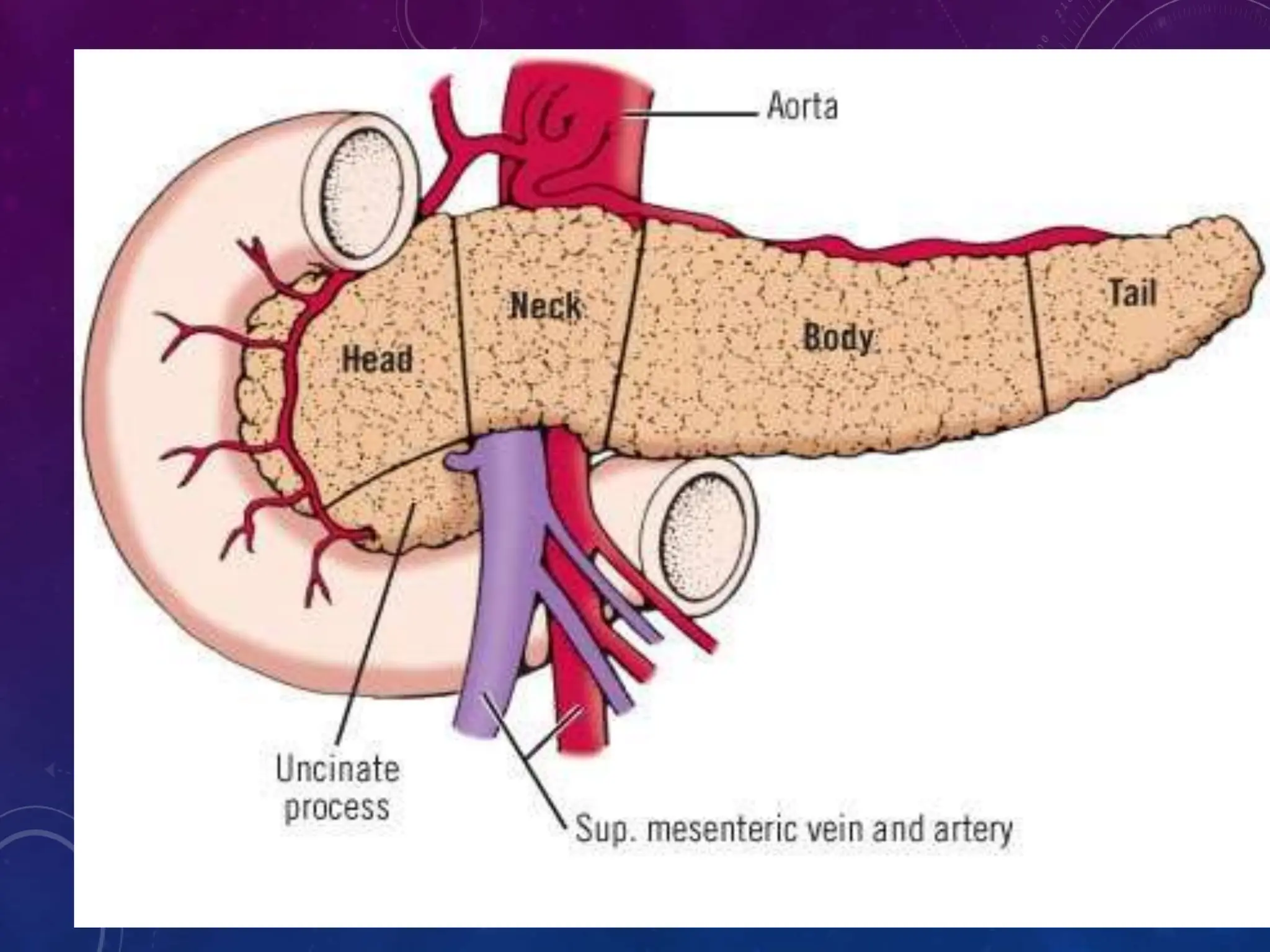 Chronic pancreatitis (2) etiology pathogenesis management.pptx