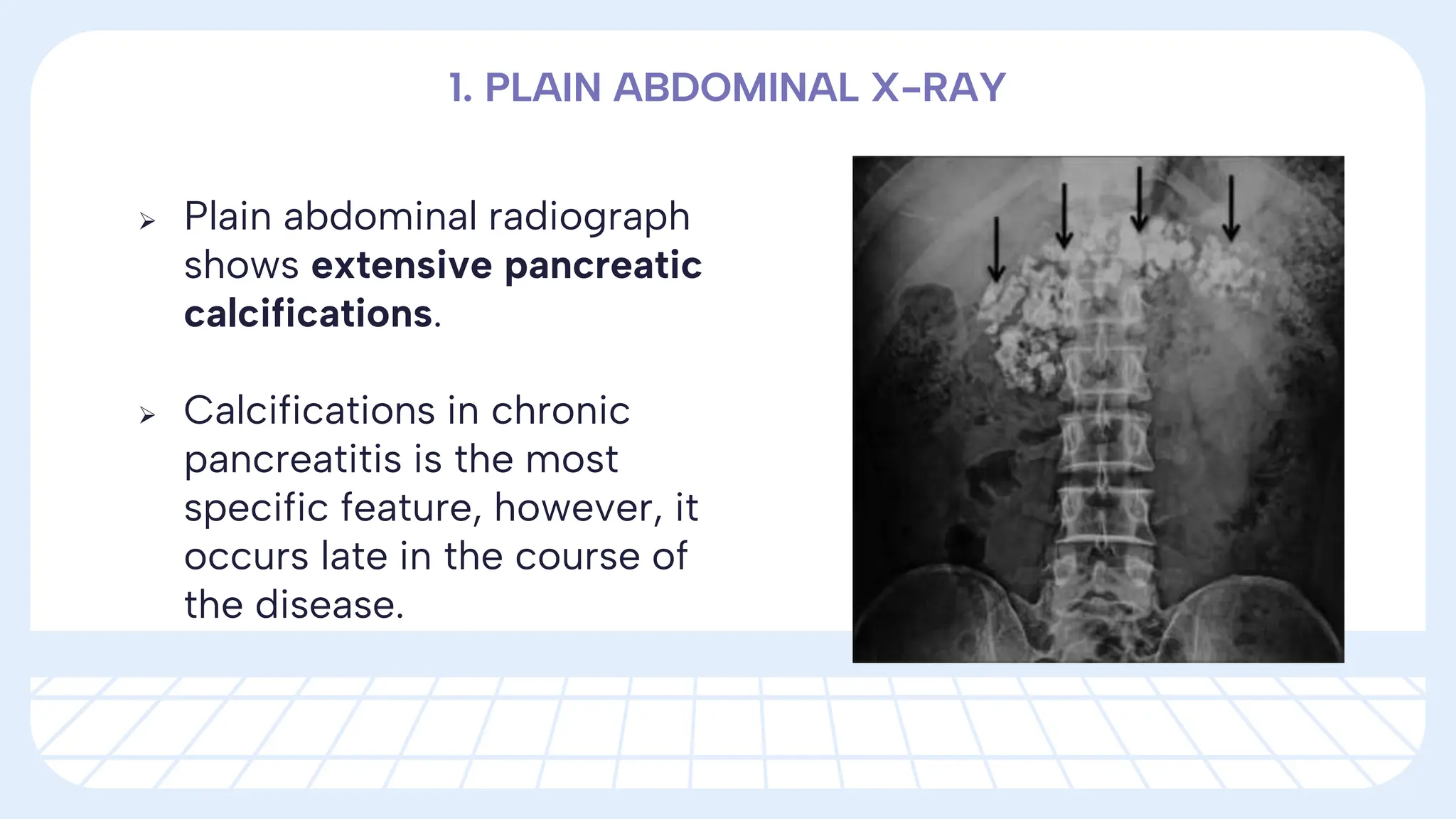 Chronic Pancreatitis (Lab and Instrumental Diagnosis).pptx