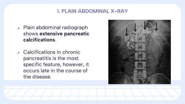 Chronic Pancreatitis (Lab and Instrumental Diagnosis).pptx