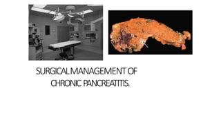 chronic panreatitis surgery presentation | PPTX