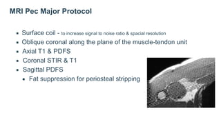 Chronic Pectoralis Major Injuries Len Funk 2020 | PPT
