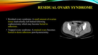 Chronic pelvic pain | PPTX