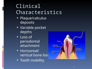 Chronic Periodontitis(Adult Periodontitis).ppt