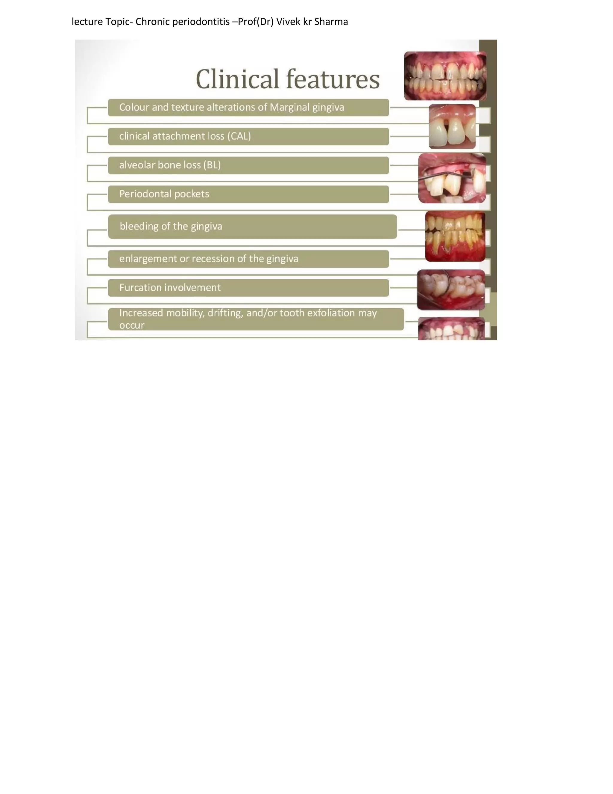 Chronic periodontitis | PDF | Dental Health | Diseases and Conditions