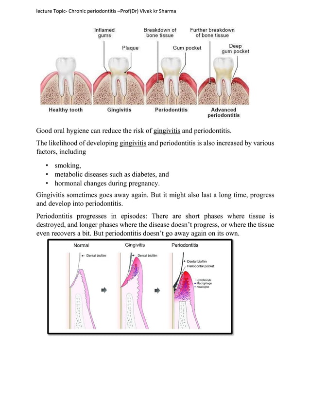 Chronic periodontitis | PDF | Dental Health | Diseases and Conditions