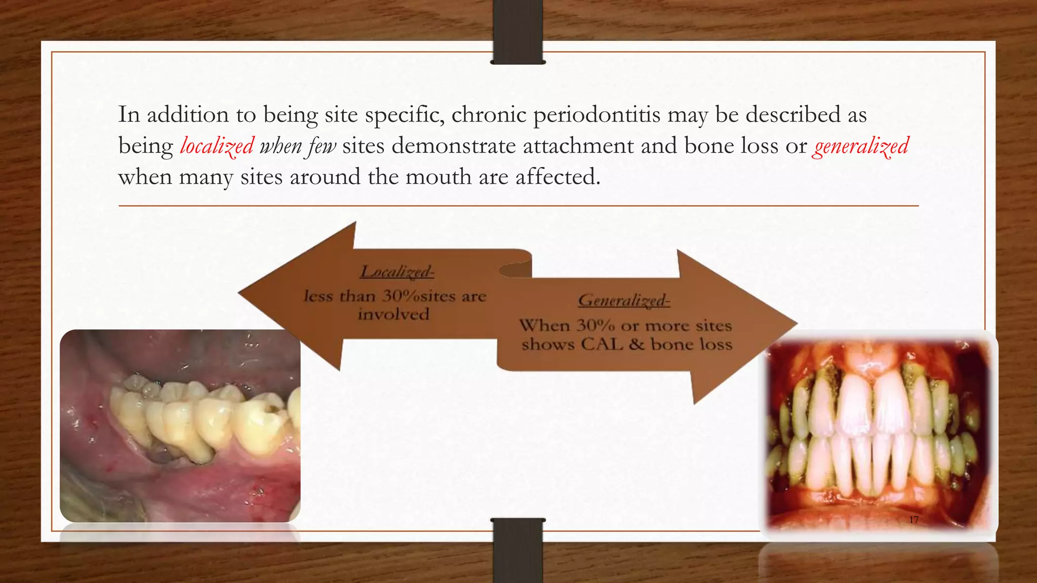 chronic periodontitis.pptx
