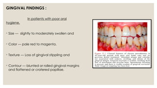 Chronic periodontitis-clinical features and risk factors | PPTX