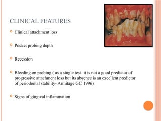 Chronic periodontitis in periodontal subject | PPTX