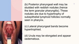 Chronic pharyngitis.pptx