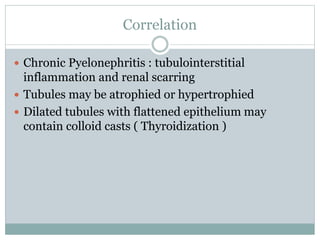 Chronic pyelonephritis | PPTX