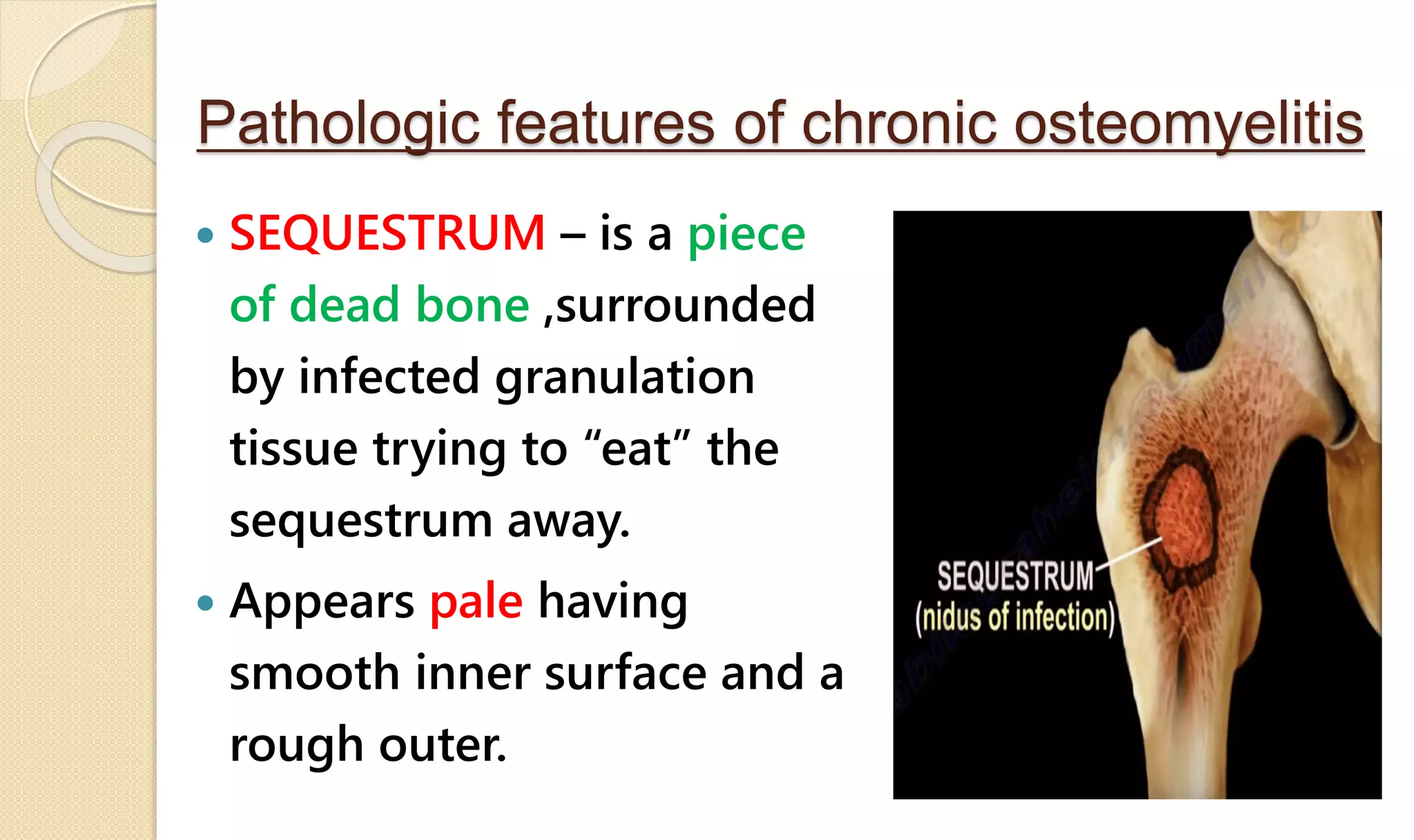 Chronic pyogenic osteomyelitis | PPTX