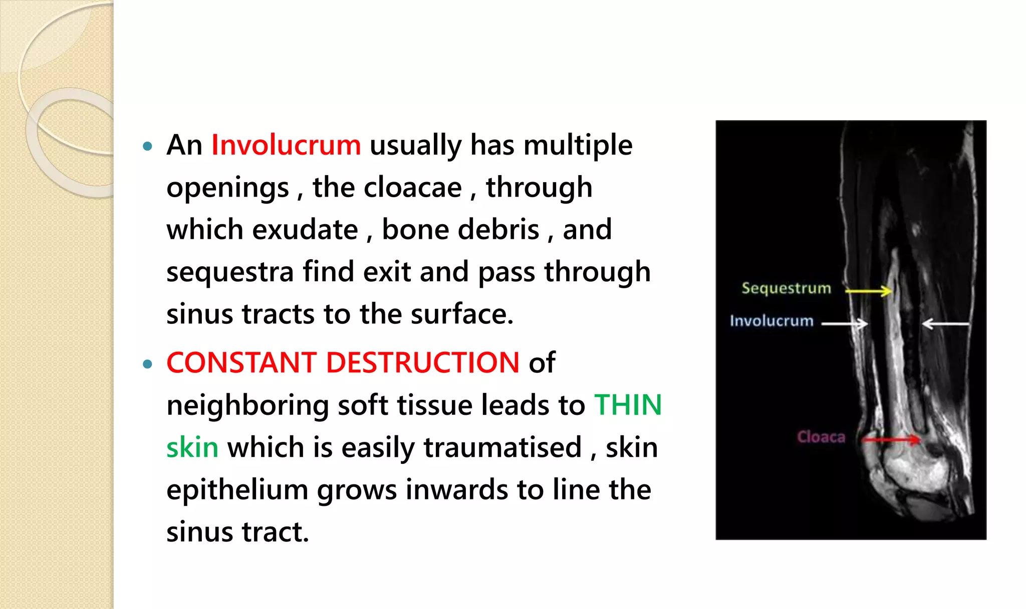 Chronic pyogenic osteomyelitis | PPTX