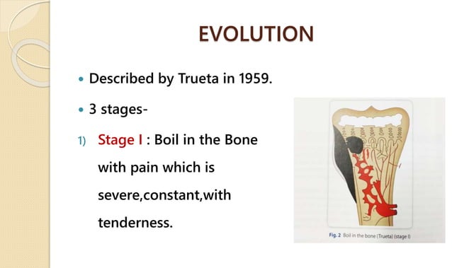 Chronic pyogenic osteomyelitis | PPTX | Bone and Joint Conditions ...
