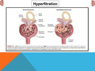 Chronic renal failure (Chronic kidney disease) Lecture 1 | PPSX ...