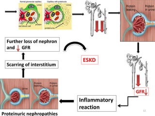 Chronic renal failure | PPTX