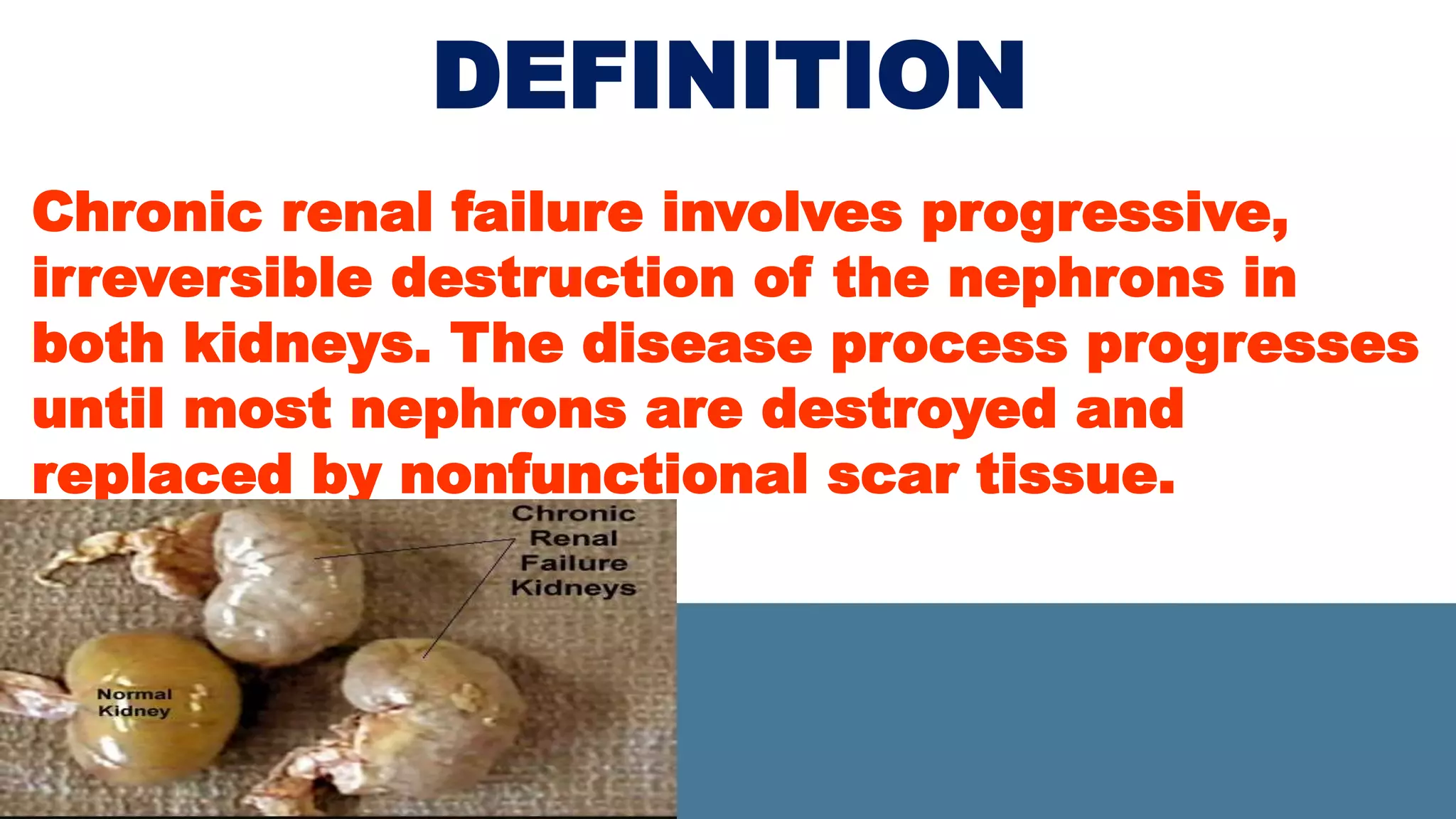 chronic renal failure.pptx